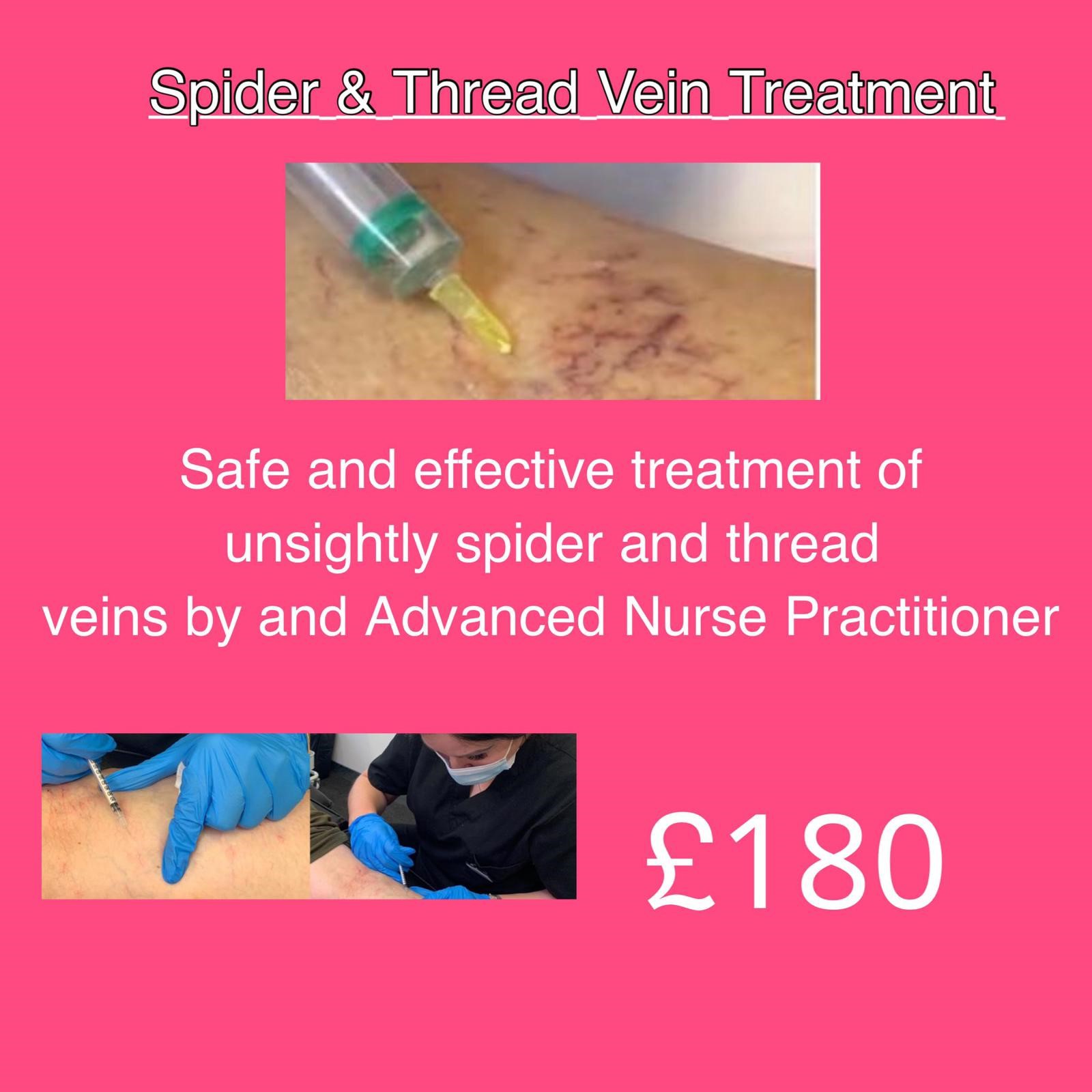 SCLEROTHERAPY- leg vein treatment - Beauty TSG